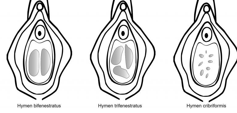 The Truth About Your Hymen - Aproko Doctor